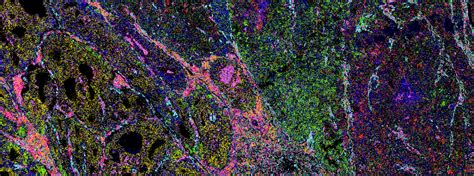 Spatial Transcriptomics Services Molecular Genomics Pte Ltd