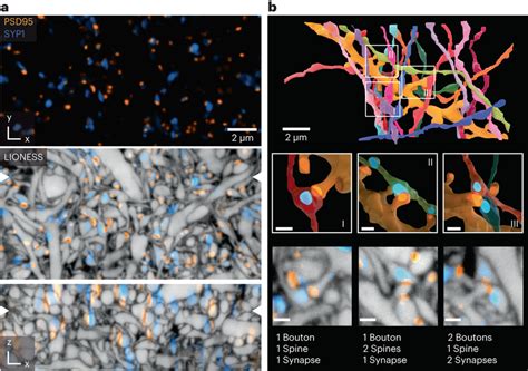 Molecularly Informed Reconstruction Of Living Brain Tissue A Confocal Download Scientific