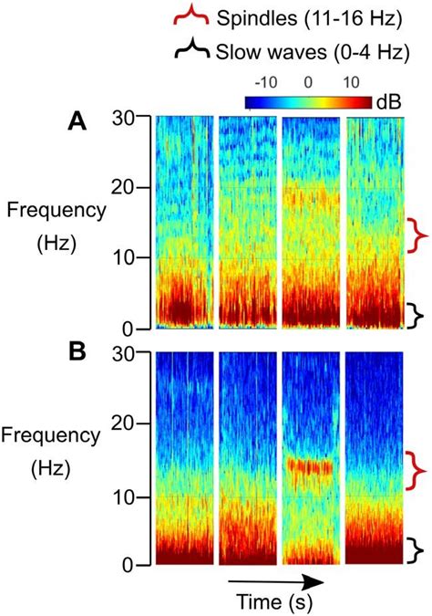 Spectrogram Comparison Of Deep Hypnosis And N3 Sleep Stage Comparison Download Scientific