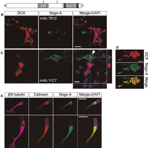 Osteotome Performing The Lumbar Partial Facetectomy Download Scientific Diagram