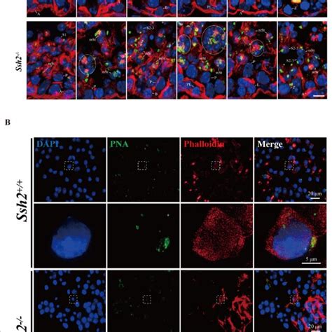 Ssh2 Knockout Ko Results In Disturbed Filamentous Actin F Actin