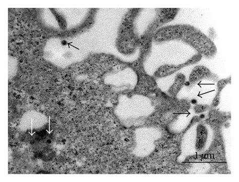 Tem Micrographs Of Nps Uptake A And B Nontreated Cells Controls Download Scientific