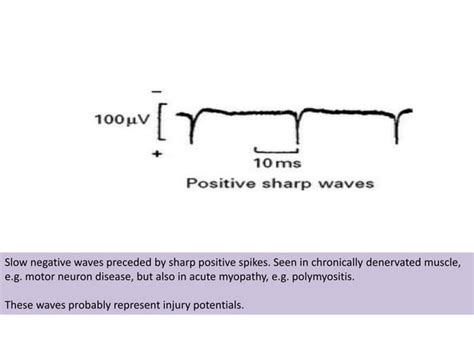 Eeg Interpretation Ppt