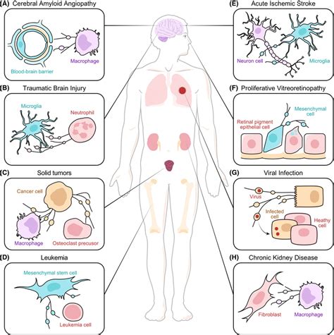 The Roles Of Migrasome In Clinical Diseases A Macrophage‐derived Download Scientific Diagram