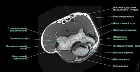 Локтевой сустав (МРТ): нормальная анатомия | e-Anatomy