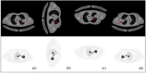Diagnostics Free Full Text Hyper Dense Lung Seg Multimodal Fusion Based Modified U Net For