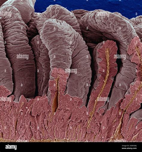 False Colour Scanning Electron Micrograph Of A Section Through The Wall Of The Human Duodenum