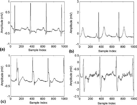 Figure 1 From Improving Ecg Classification Accuracy Using An Ensemble