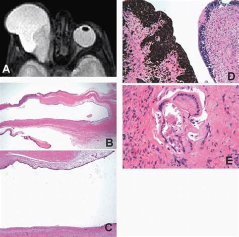 Congenital Anomalies Ento Key