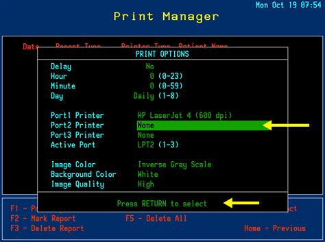 Switching To A Virtual Printer In DPX Flux Software