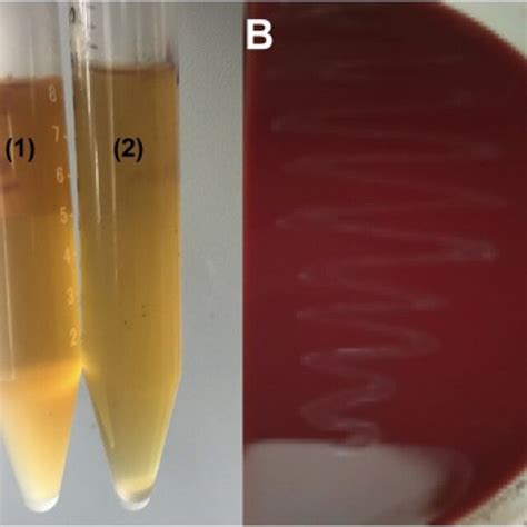 Growth Of Enterococcus Sp Be11 Isolate On Liquid Mrs And Blood Agar