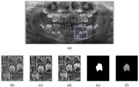 Output Images Based On The Sequence Steps Of Segmentation Operation Download Scientific