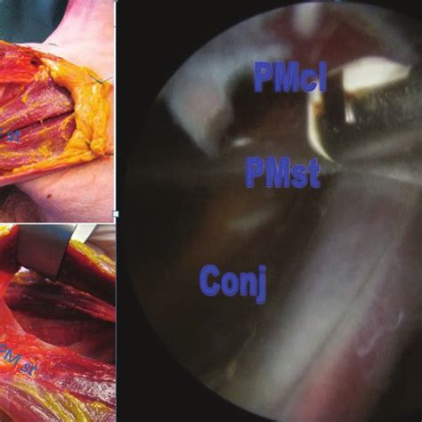 Classification According To Sugaya Et Al 16 A Type I—normal