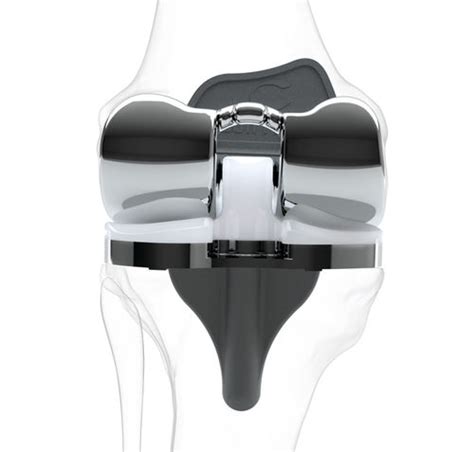 Total Knee Prosthesis Itotal Ps Conformis Sliding Posterior