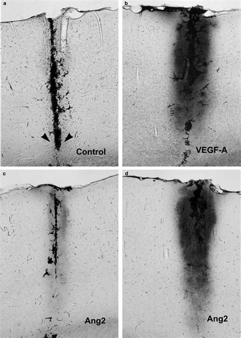 The Intracortical Injection Model A Cortex Of A Vehicle Injected Download Scientific Diagram