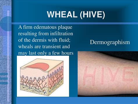 Ppt Dermatology Powerpoint Presentation Free Download Id333669