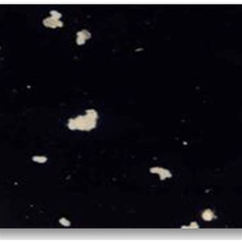 Positive Microscopic Agglutination Test Mat At A Titre Of 1 640 Download Scientific Diagram