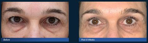 Agejet™ Aesthetic Record Marketplace