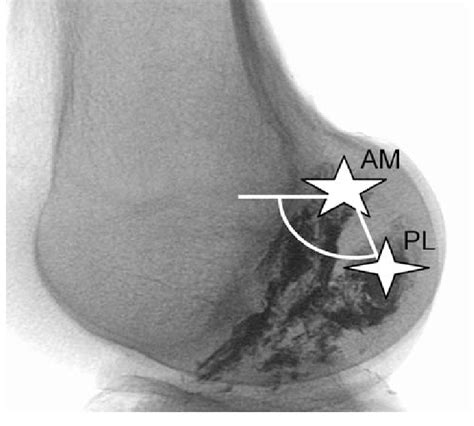 Schema Of Angle Measurement Download Scientific Diagram