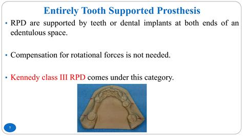 RPI RPA System PPTX Dental Health Diseases And Conditions