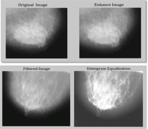 Preprocessing Of The Image Download Scientific Diagram