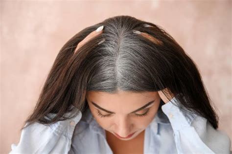 Ini 5 Penyebab Uban Tumbuh Sebelum Waktunya