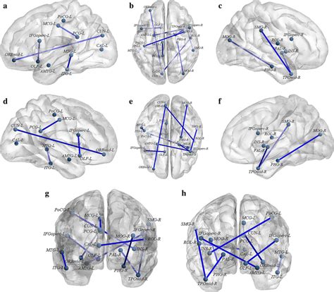 Top 10 Most Discriminative Brain Functional Connections Determined By