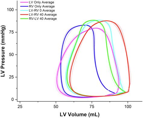 Clinical Applications Of Pressure Volume Assessment In Congenital Heart