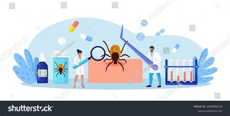 Prevention Lyme Encephalitis Diseases Removing Encephalitis Stock Vector Royalty Free