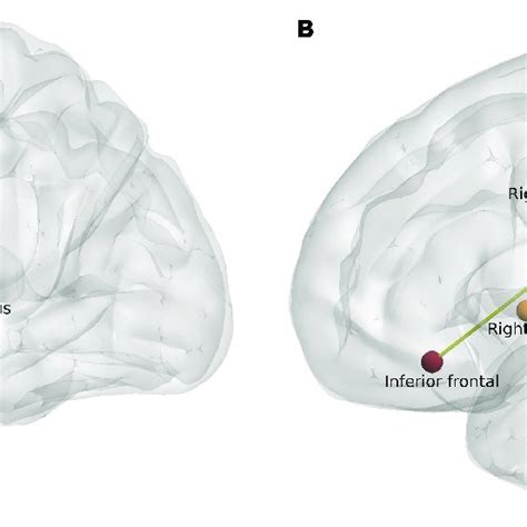 Network Based Statistic Derived Subnetworks A Left Sagittal View