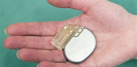 Pacemakericd Bleeding Complication Increases Risk Of Serious