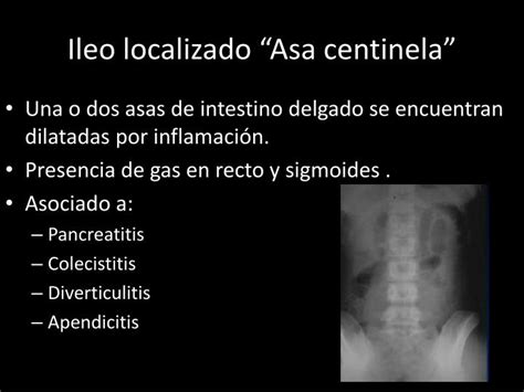 Ppt Abdomen I Powerpoint Presentation Id4157310