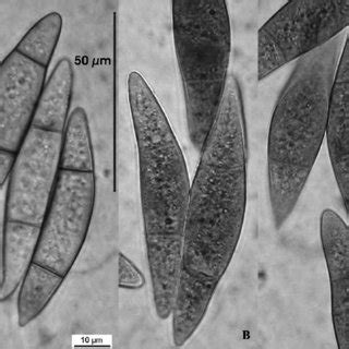 Conidiophores And Conidia Of Nimbya Dianthi From Holotype Download Scientific Diagram