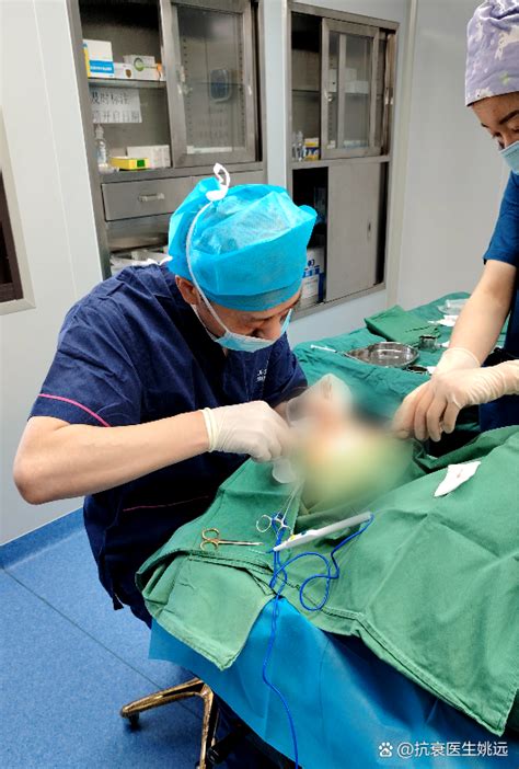 精准剥离拉皮手术后3个月,切口疤痕展示,真实无p图 精准剥离拉皮手术后3个月,切口疤痕展示,真实无p图