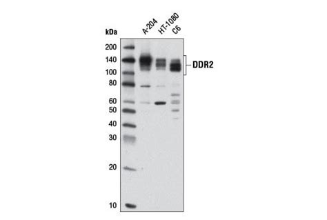 DDR Antibody Cell Signaling Technology