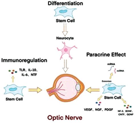 Mesenchymal Stem Cells For Repairing Glaucomatous Optic Nerve Pmc