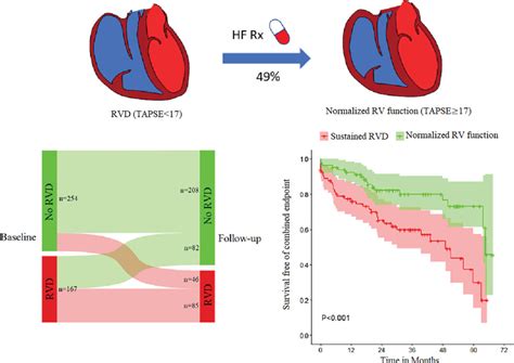 Right Ventricular Dysfunction In Patients With New‐onset Heart Failure
