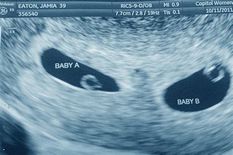 Happy 9th Birthday Inez And Mateo Omar A Eaton Martinez