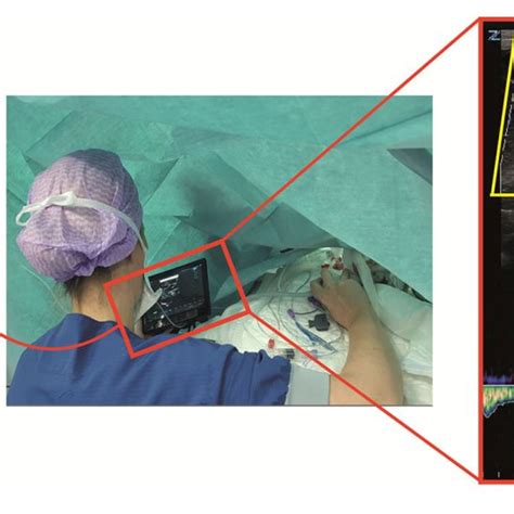 Ultrasound Measurement Setup Left One Researcher Controlled The Download Scientific