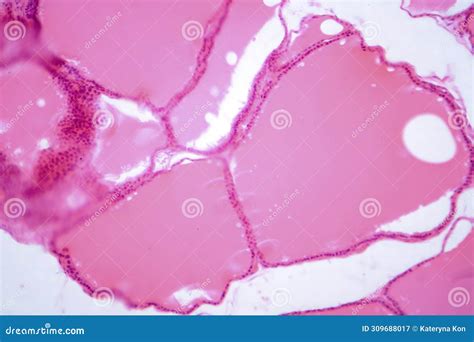 Thyroid Gland Under A Microscope Light Micrograph Exhibiting Typical