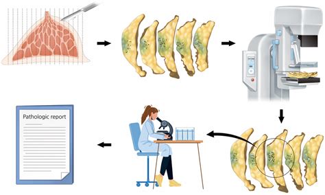 Classification And Inclusion Criteria Of The Reduced Mass With No