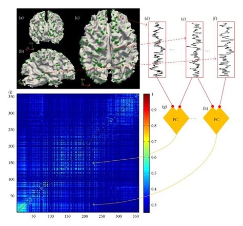 Functional Connectivity Fc Was Measured Across The Brain Using The Download Scientific