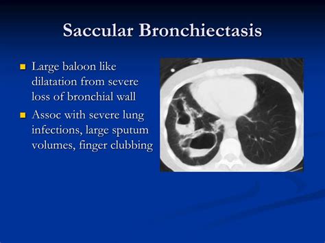 Ppt Chronic Lung Sepsis Powerpoint Presentation Free Download Id 3923480