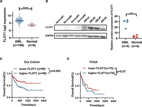 A Mrna Level In Aml Whole Bm Unsorted Except For T 1517 And