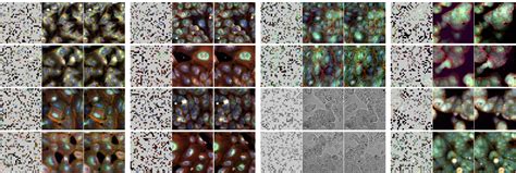 Figure 1 From Masked Autoencoders For Microscopy Are Scalable Learners