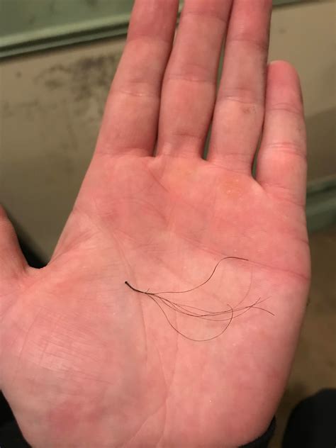 Found Another Crazy Looking Pili Multigemini In My Beard Today Rpopping