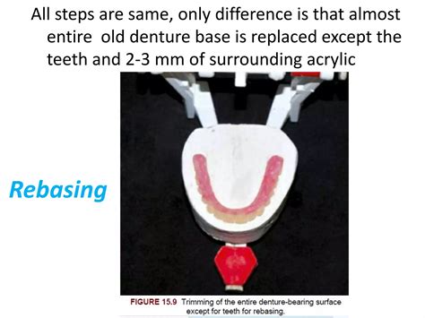 Relining And Rebasing In Complete Dentures Pptx