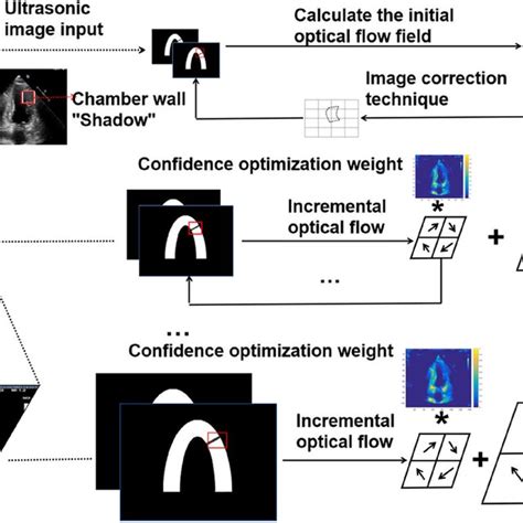 Motion Vector Decomposition Of The Cardiac Ventricular Wall A