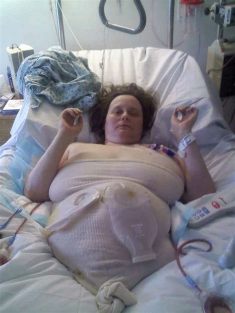 Despite Operation To Cut Her In Half Angel Laughs On