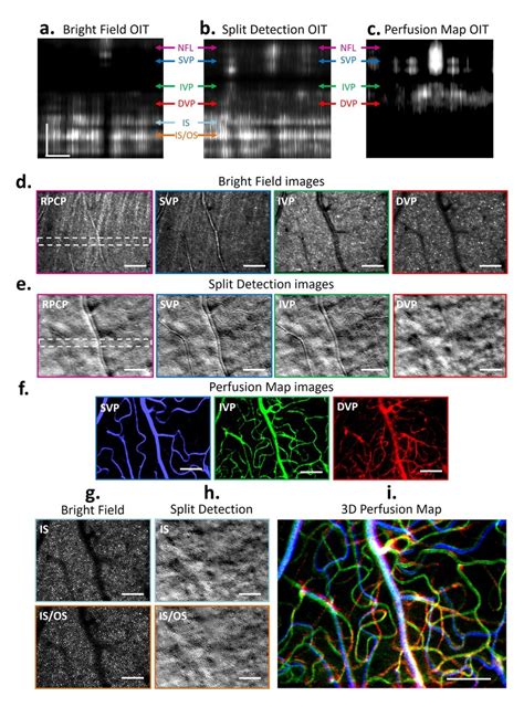 A C Tomographic Retinal Cross Sections Generated By Respectively